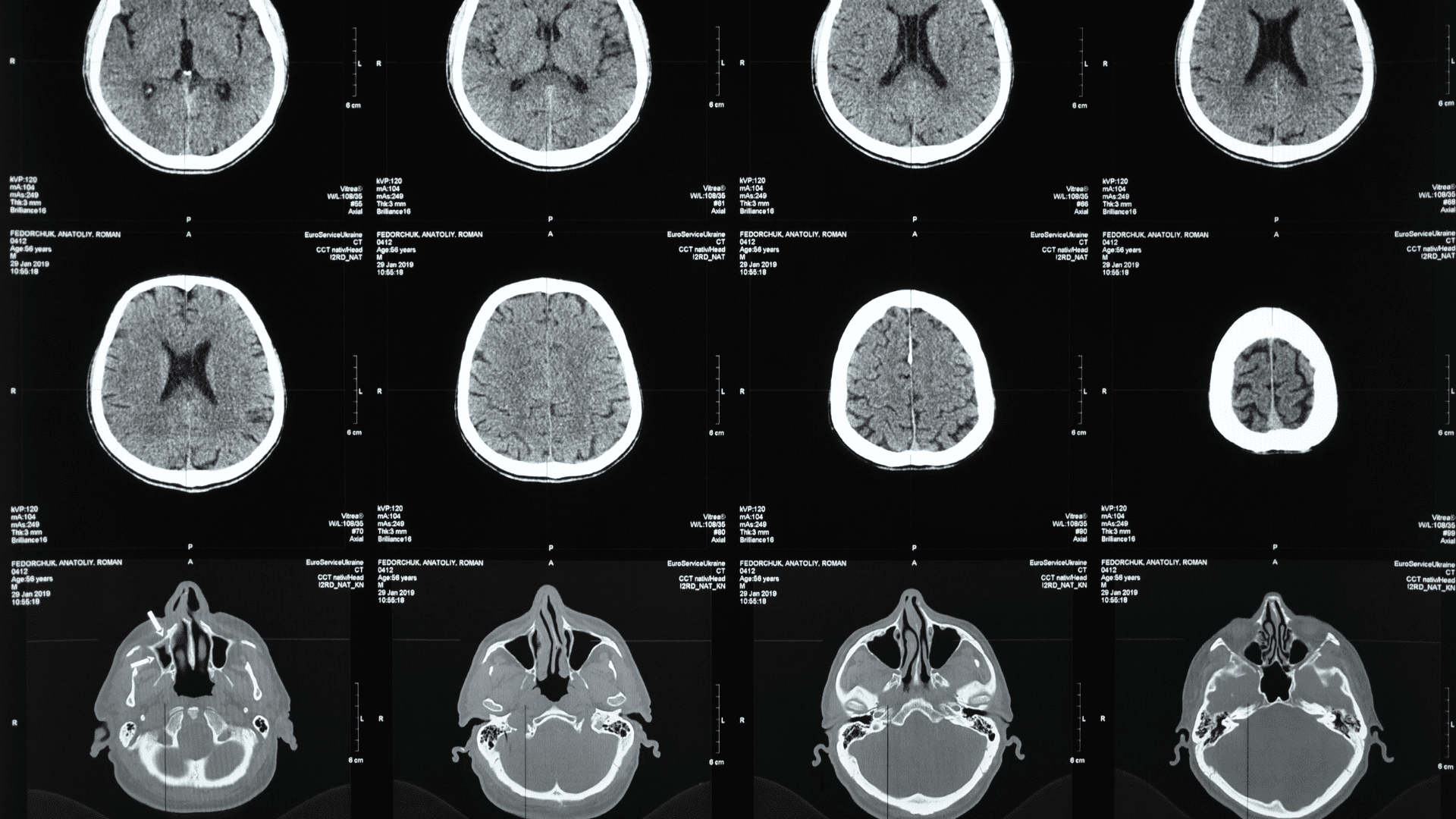 The Evolution of the Human Brain - John Templeton Foundation